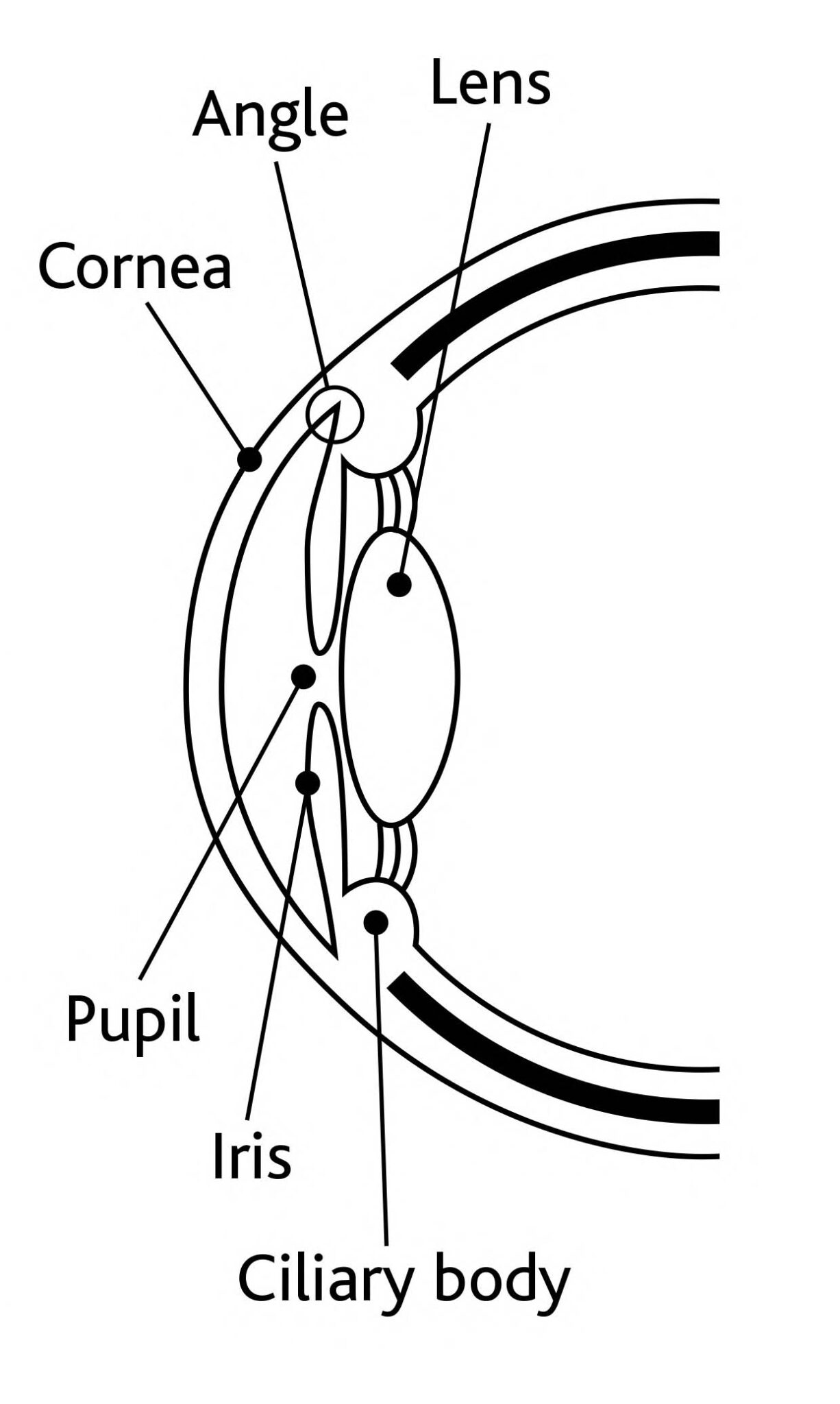 Angle closure glaucoma (Narrow drainage channel in the front of your ...